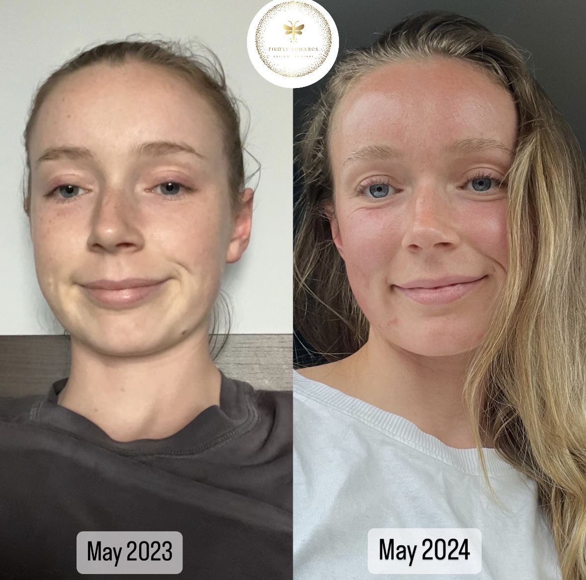 Guided Psychosomatic Healing Programme – Firefly Somatics™